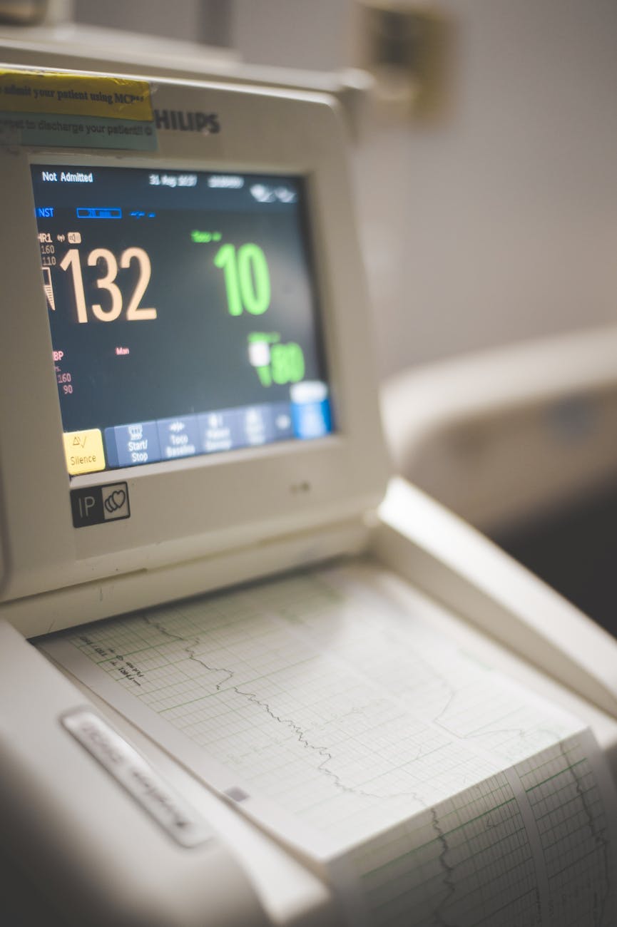 Is SVT Same as PSVT? – LBS Healthcare